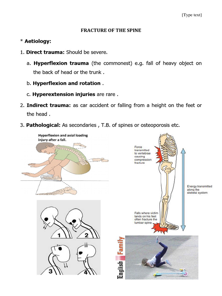 Diseases of Vertebral Column | PDF | Vertebral Column | Spinal Cord
