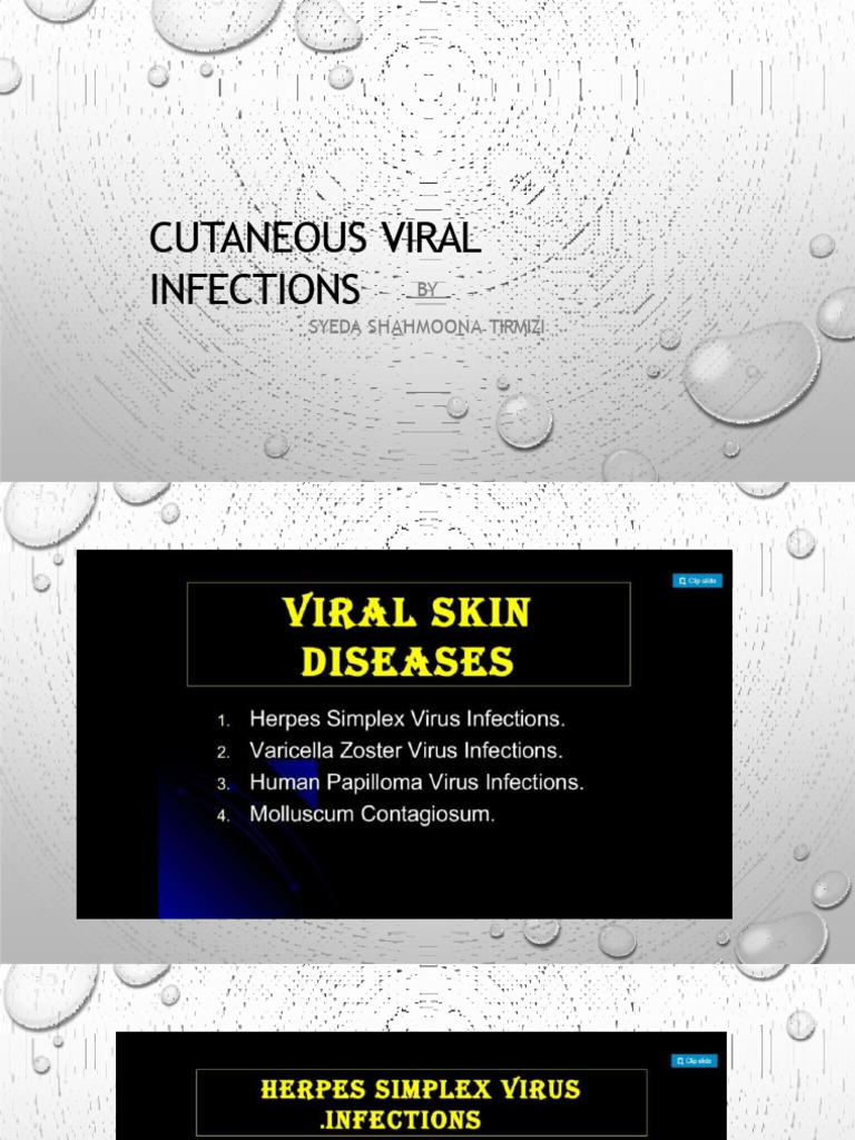 Cutaneous Viral Infections: BY Syeda Shahmoona Tirmizi | PDF