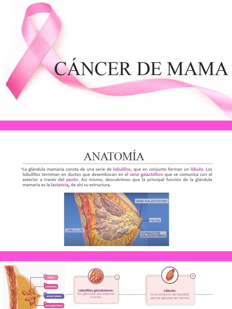 Cáncer de Mama | PDF