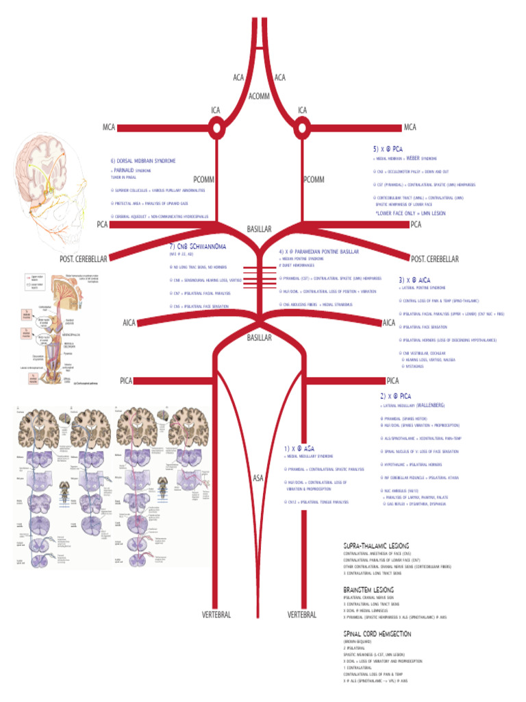 Brainstem Stroke Syndreoms Pdf Nervous System Neuroscience