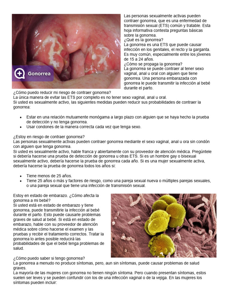 Gonorrea Pdf