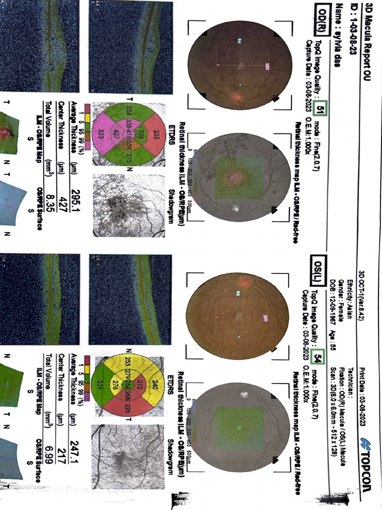 Retina Scan Report | PDF | Visual System | Human Eye