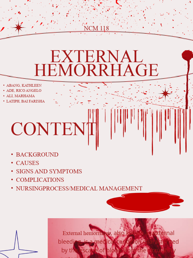 External Hemorrhage 1 | PDF | Injury | Bleeding