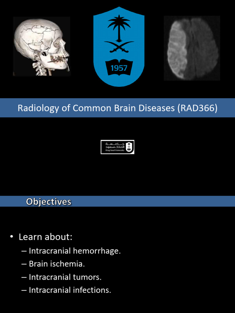 10 - RAD366 Radiology of Common Brain Diseases | PDF