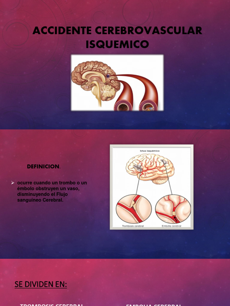 ACV Isquémico: Definición y Tratamiento | PDF | Ciencia y matemáticas