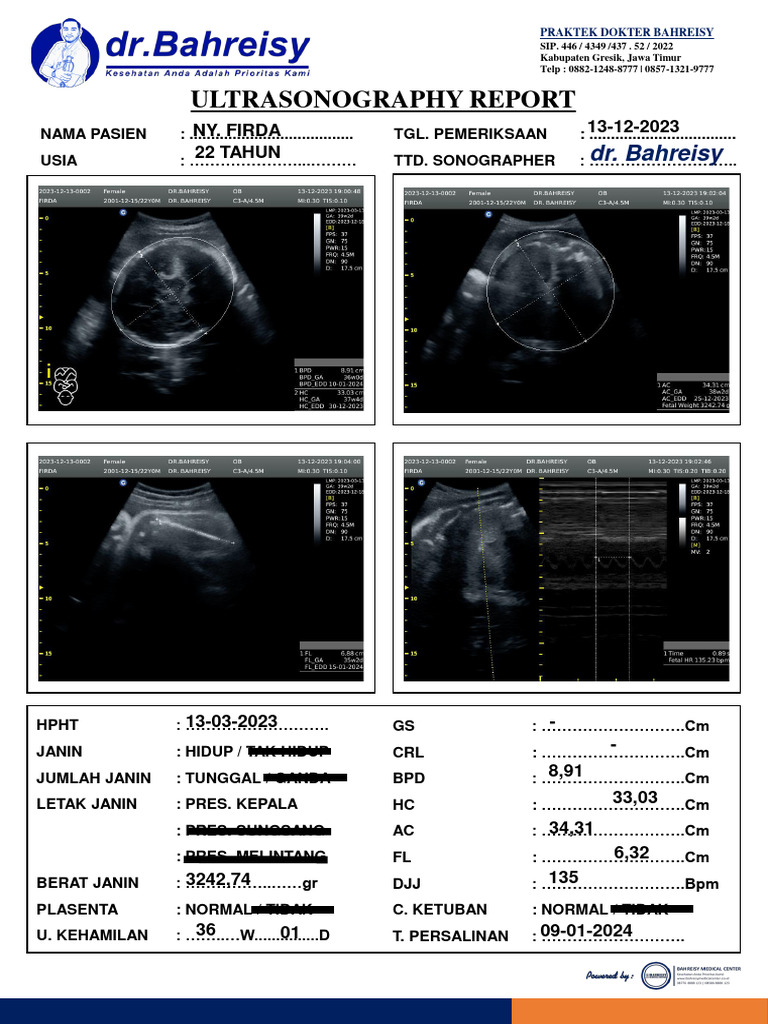 USG Asfgeshystar | PDF