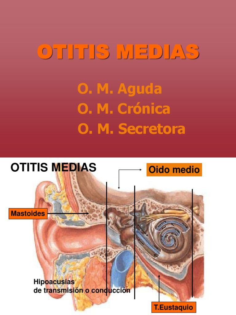 Otitis y Mastoiditis | Oído | Ciencias de la Salud