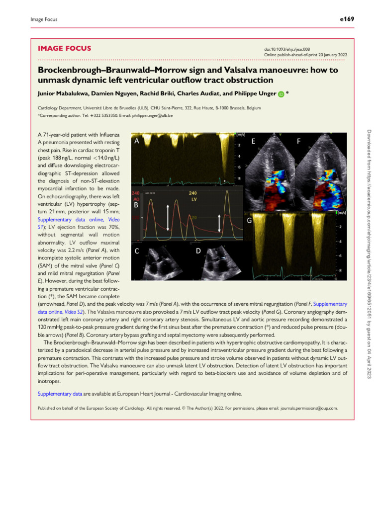 Brockenbrough-Braunwald Sign in LV Obstruction | PDF | Cardiovascular ...