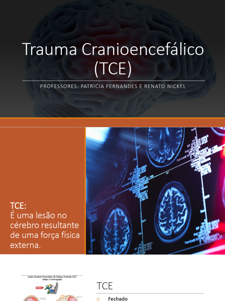 Aula Tce | PDF
