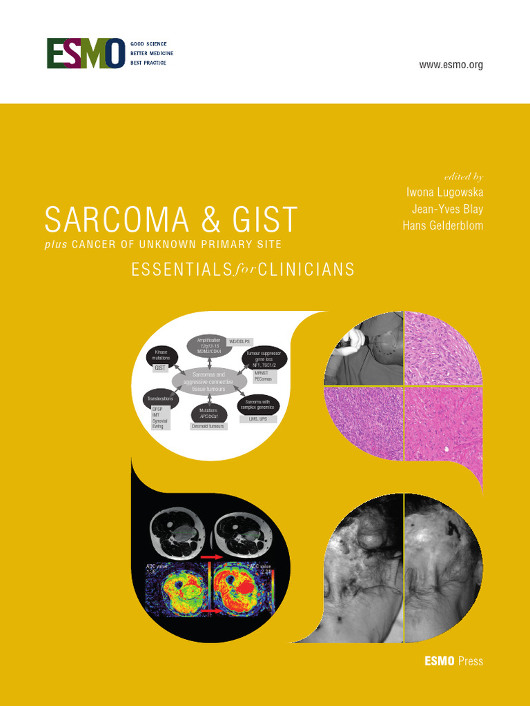 ESMO-Sarcoma-GIST-and-CUP-Essentials-for-Clinicians | PDF | Sarcoma | Oncology
