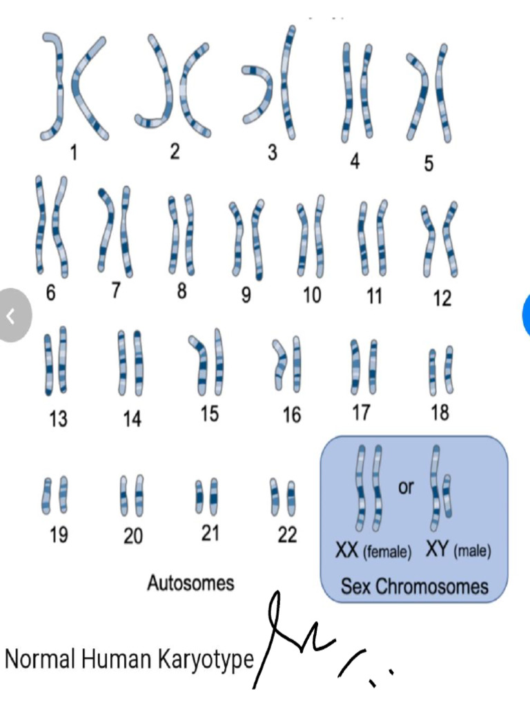 Human Ploidy Karyotype | PDF