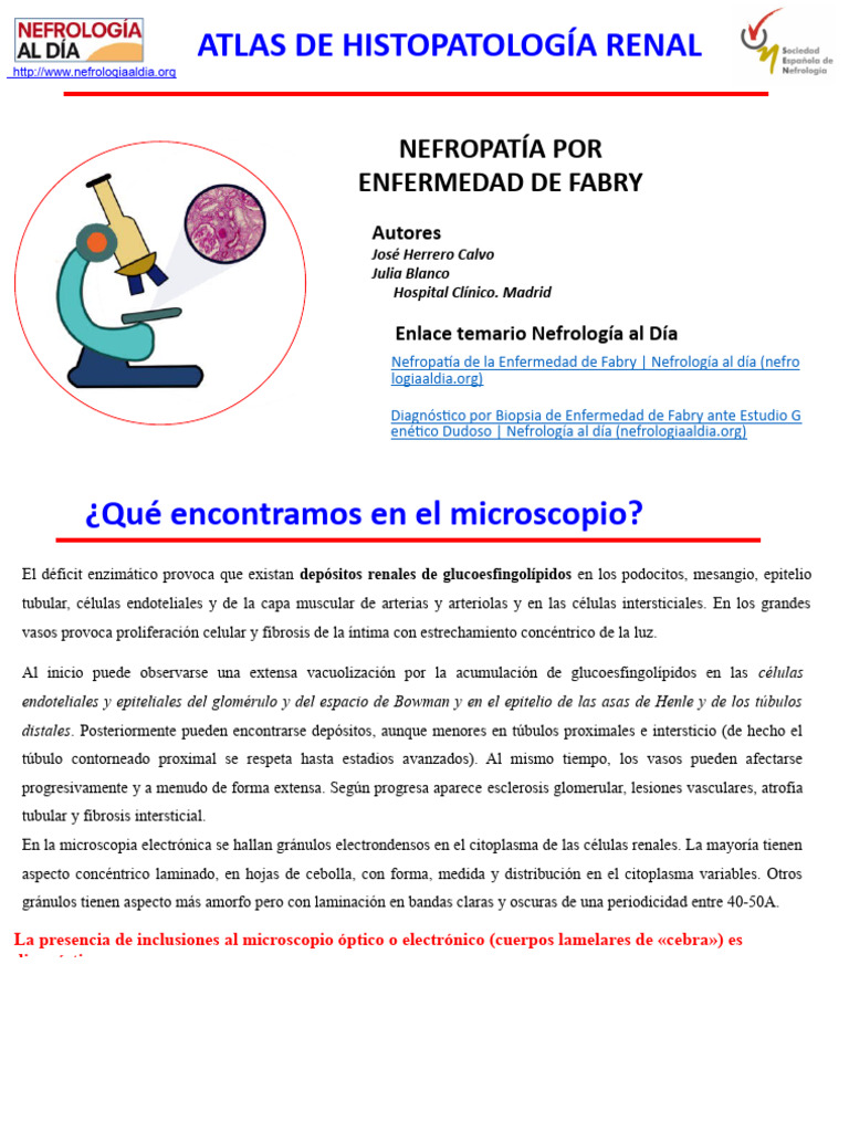 Histopatología Renal en Enfermedad de Fabry | PDF | Riñón | Anatomía
