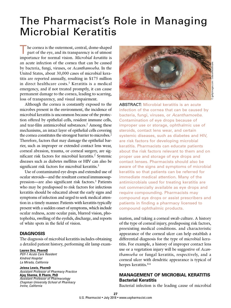 Managing Microbial Keratitis | PDF | Contact Lens | Cornea