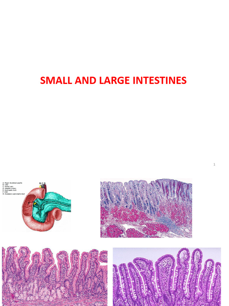Intestinal Disorders Overview | PDF | Ulcerative Colitis | Crohn's Disease