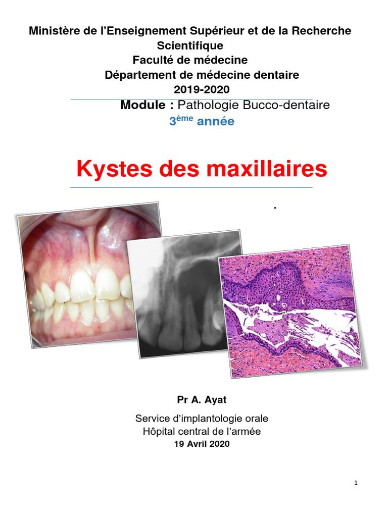Kystes folliculaires dentaires : diagnostic et traitement | PDF ...