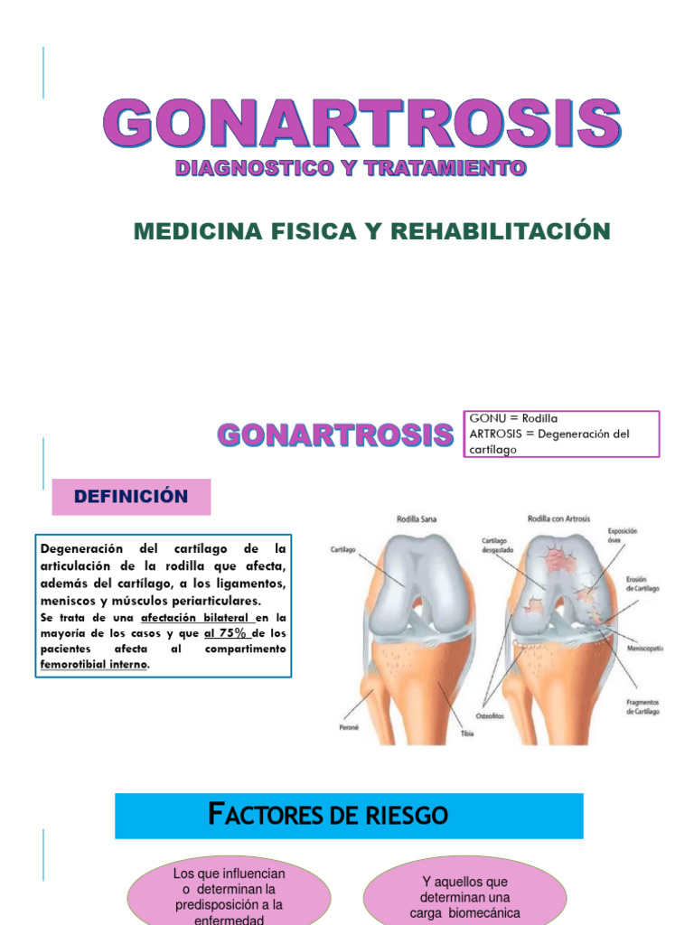 Expo Gonartrosis | Descargar gratis PDF | Rodilla | Articulación