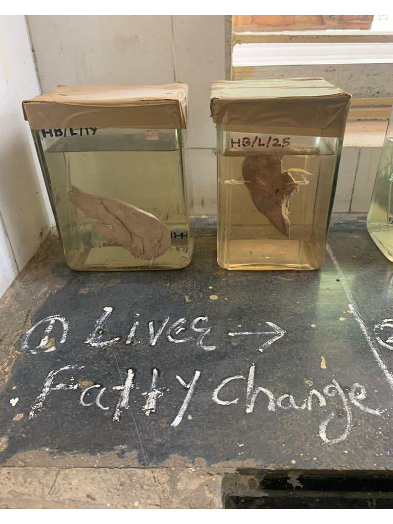 Liver N Blood Gross Specimens | PDF