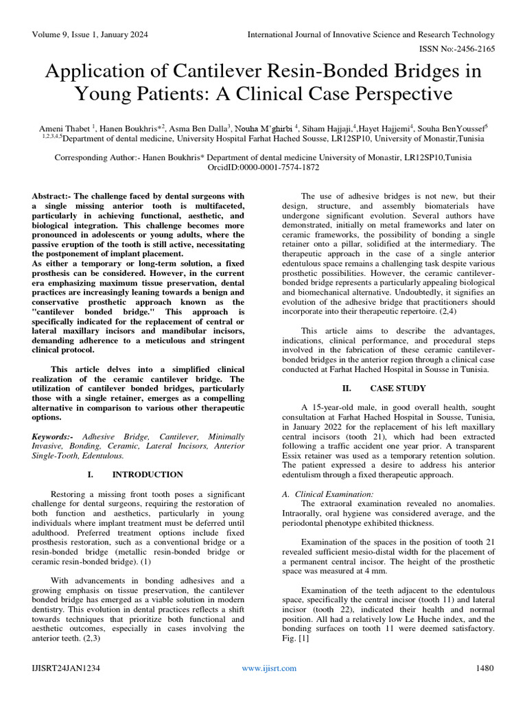 Application of Cantilever Resin-Bonded Bridges in Young Patients: A ...