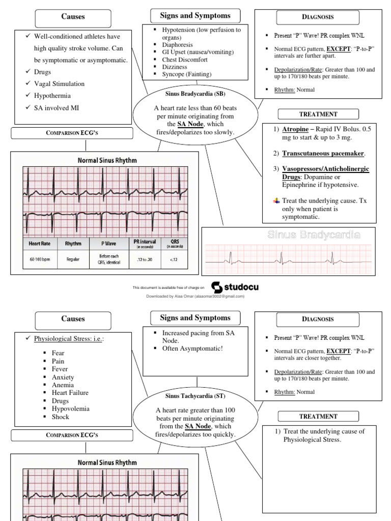 Cardiac Dysrhythmias Concept Maps | PDF