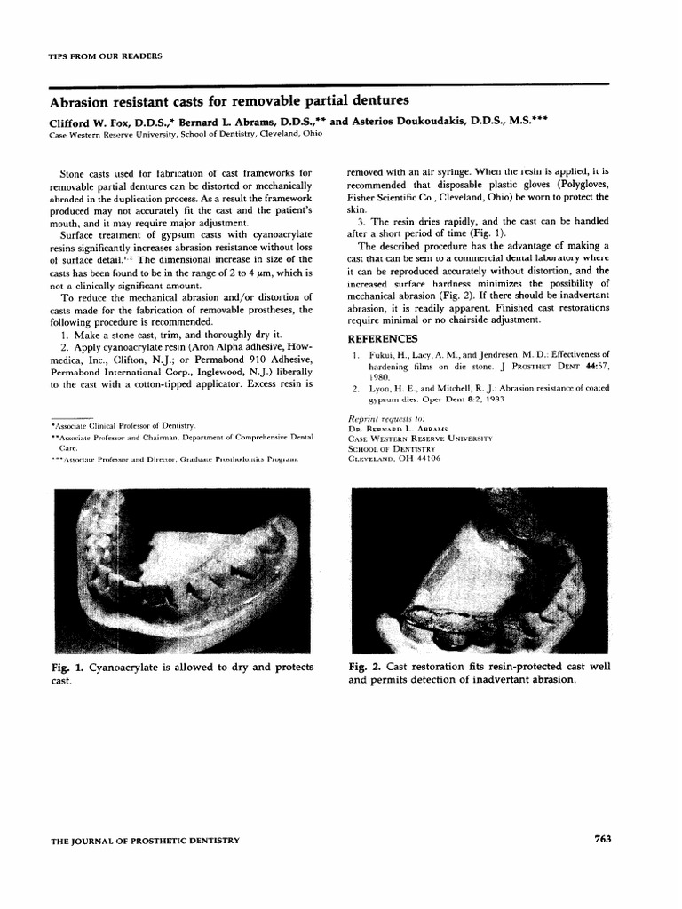 1984 Abrasion Resistant Casts For Removable Partial Dentures | PDF ...