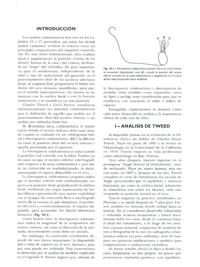 Anlisis de Tweed | PDF