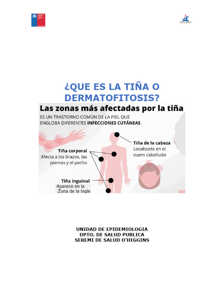 Antecedentes y Medidas Preventivas de La DERMATOFITOSIS (Tiña) | PDF ...