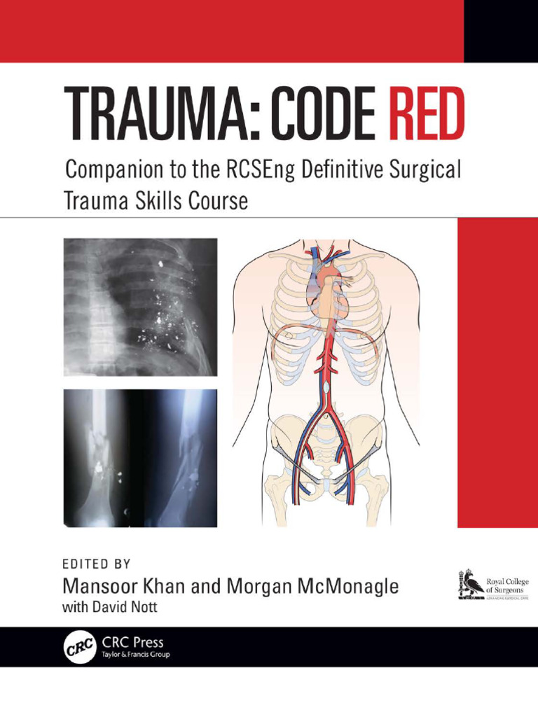 Trauma, Code Red Companion To The Rcseng Definitive Surgical Trauma ...