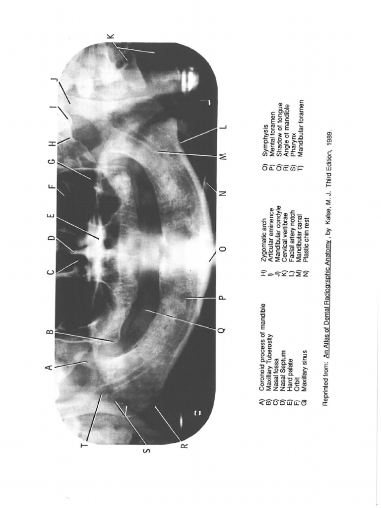 complete_denture_anatomical_landmarks | PDF