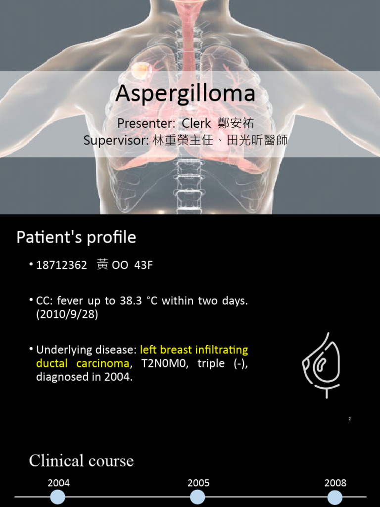Aspergilloma 鄭安祐 | PDF | Diseases And Disorders | Clinical Medicine