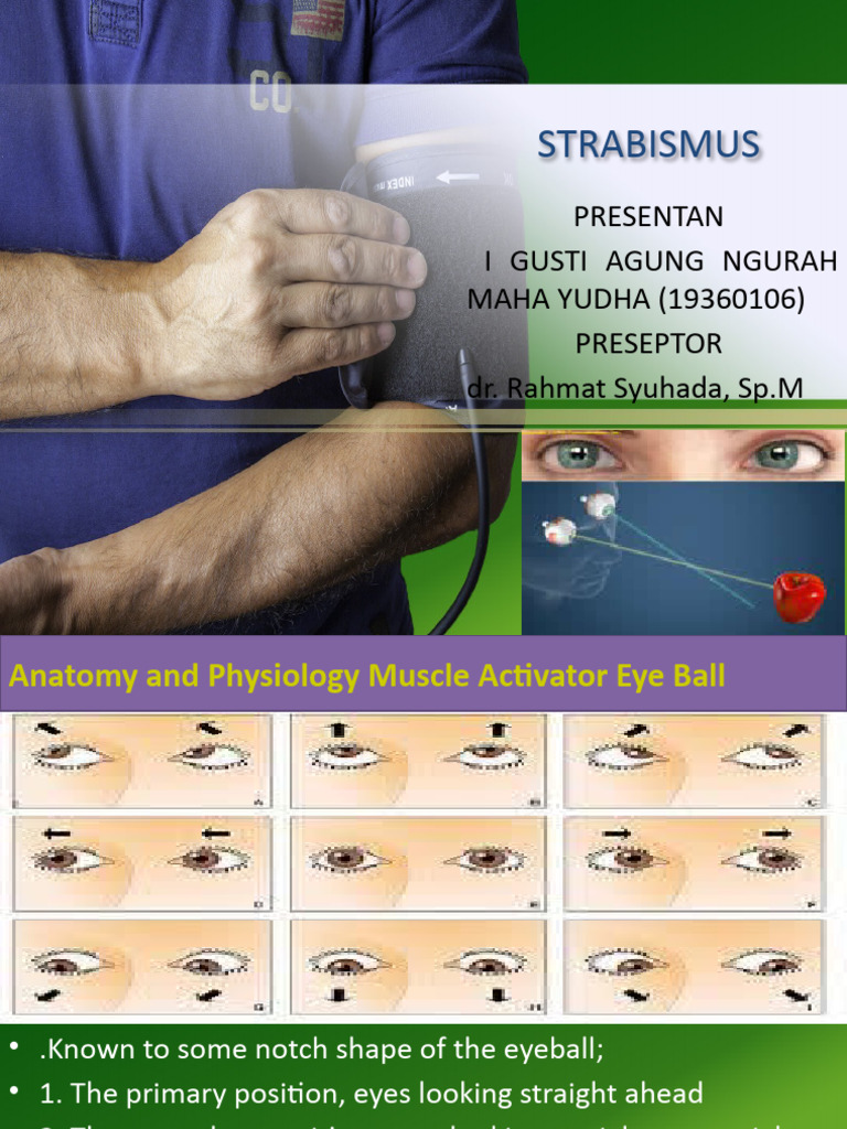 Referat Strabismus | PDF