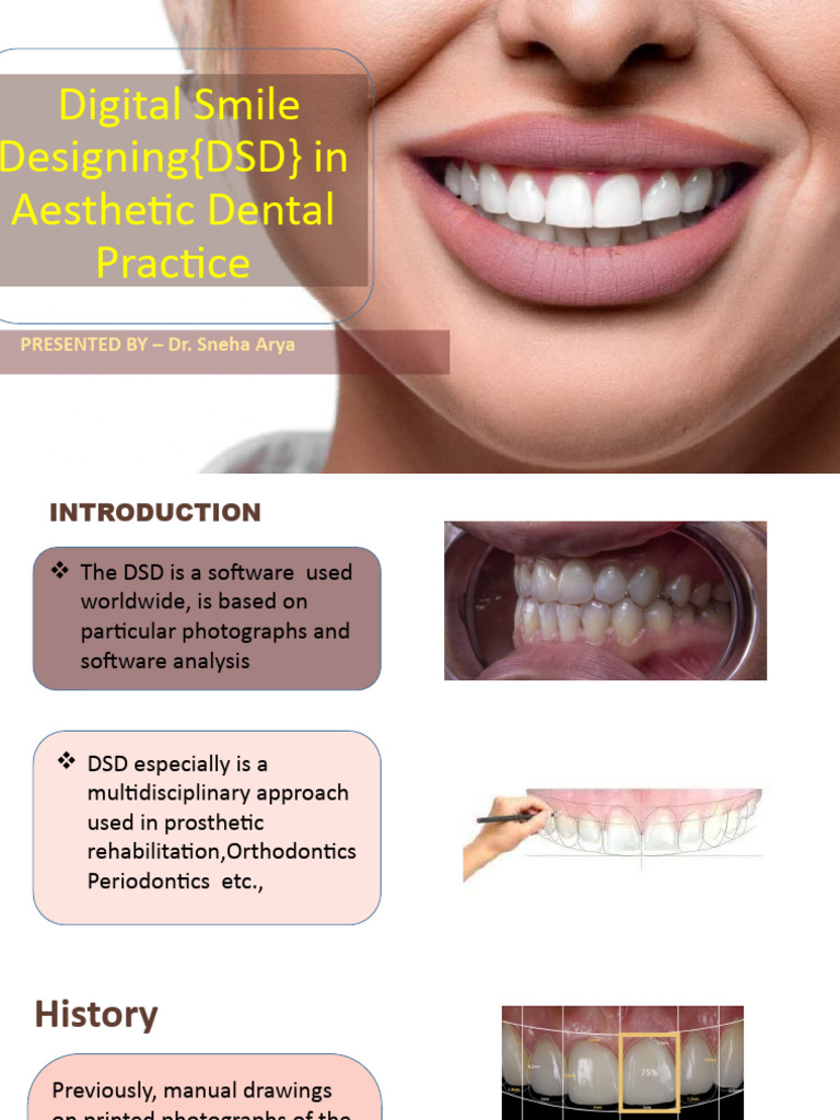 Digital Smile Designing (DSD) in Aesthetic Dental Practice | PDF ...
