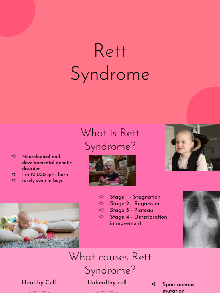 Rett Syndrome | PDF | Epidemiology | Clinical Medicine