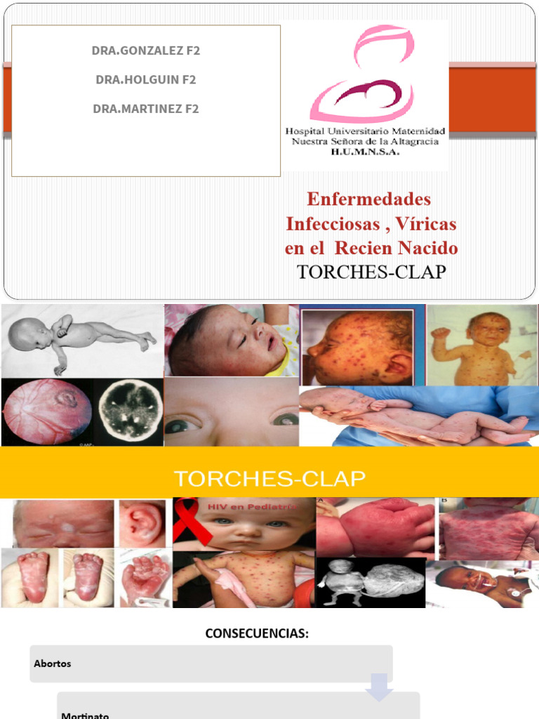 Humnsa Torch Clap | PDF | Ciencia y matemáticas