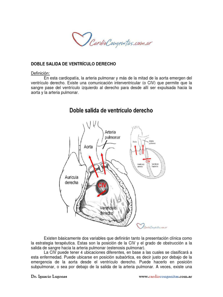 Doble Salida de Ventriculo Derecho | PDF | Corazón | Insuficiencia cardíaca