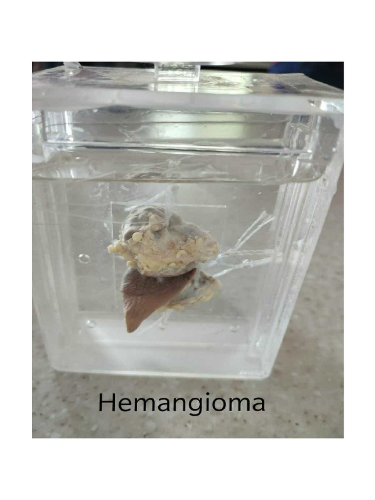 Pathology University - Gross Specimen | PDF