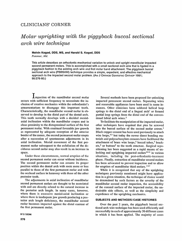 Molar Uprighting With Arch Wire Technique The Piggyback Buccal ...