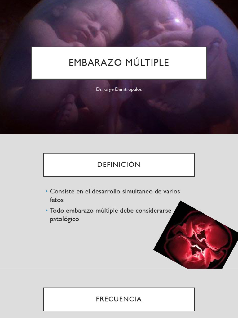 Embarazo Multiple | PDF
