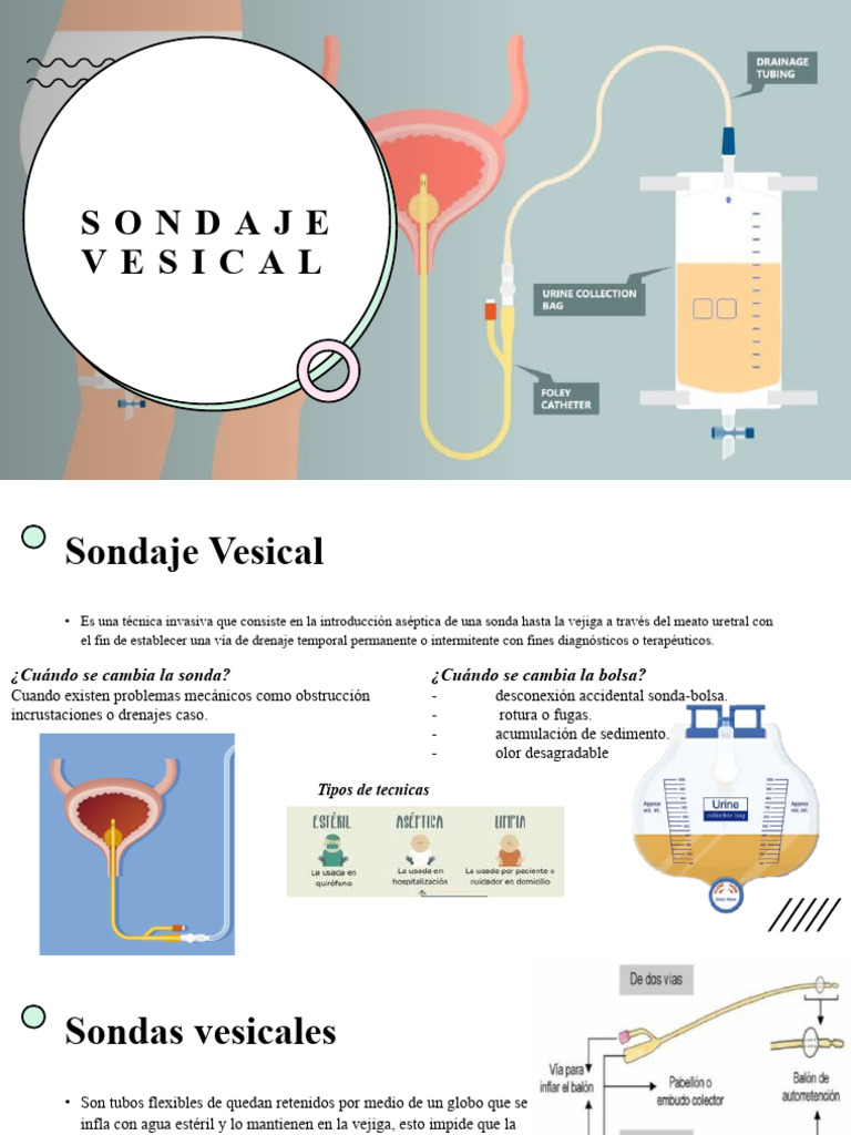 Sondaje Vesical: Procedimientos y Cuidados | PDF | Sistema urinario ...