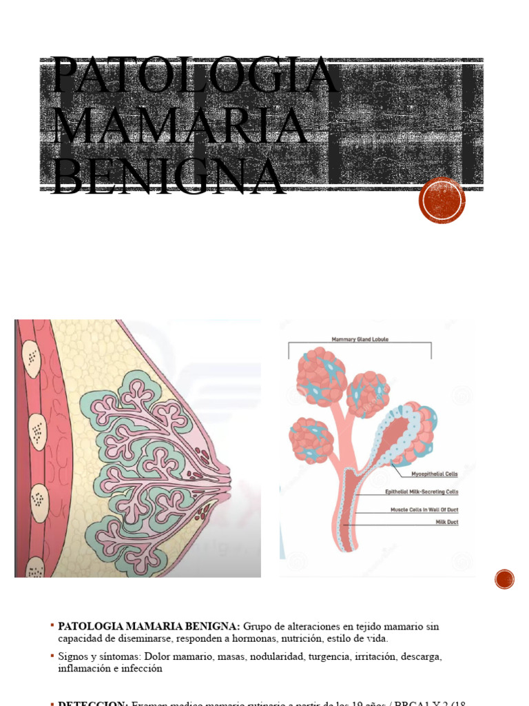 Tumores Benignos de La Mama | PDF | Pecho | Causas de la muerte
