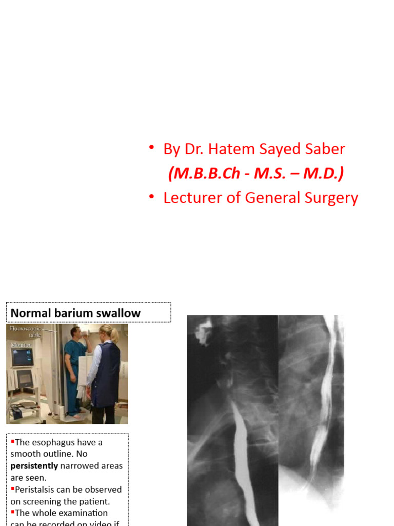 02-Upper GIT Slides 1 | PDF | Esophagus | Gastroesophageal Reflux Disease