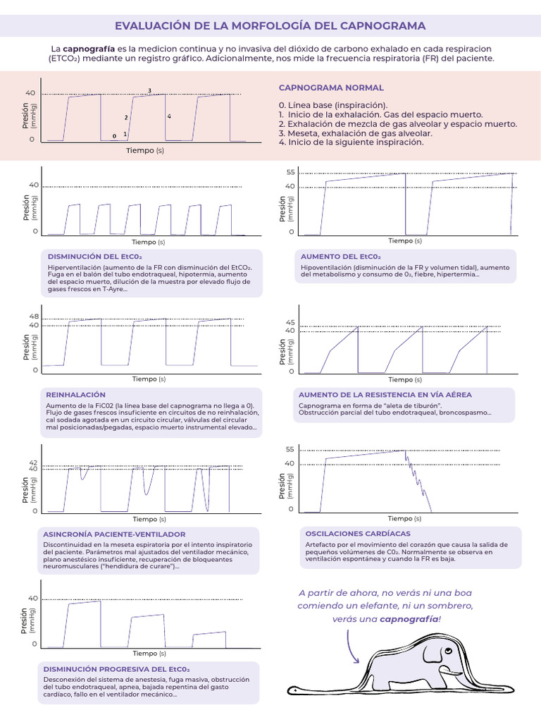 Capnografía Normal y su Interpretación | PDF | Medicina CLINICA | Medicina