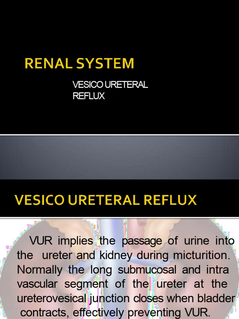 Vesico Ureteral Reflux | Download Free PDF | Clinical Medicine ...