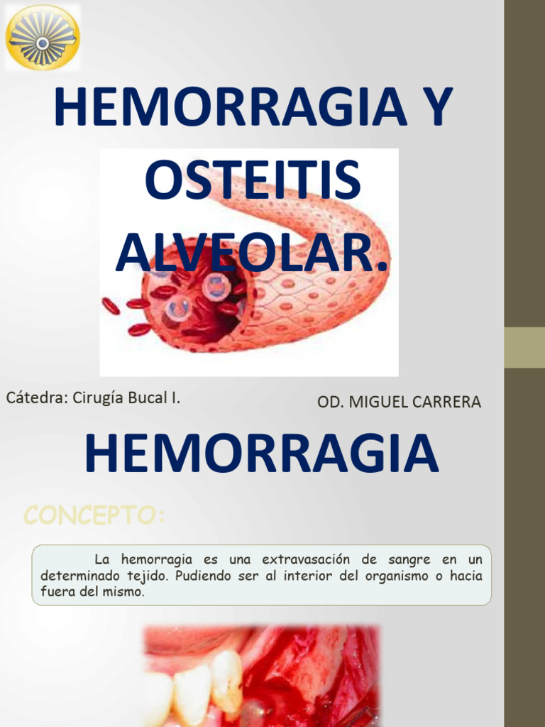Hemorragia y Osteítis Alveolar | PDF | Coagulación | Hemofilia