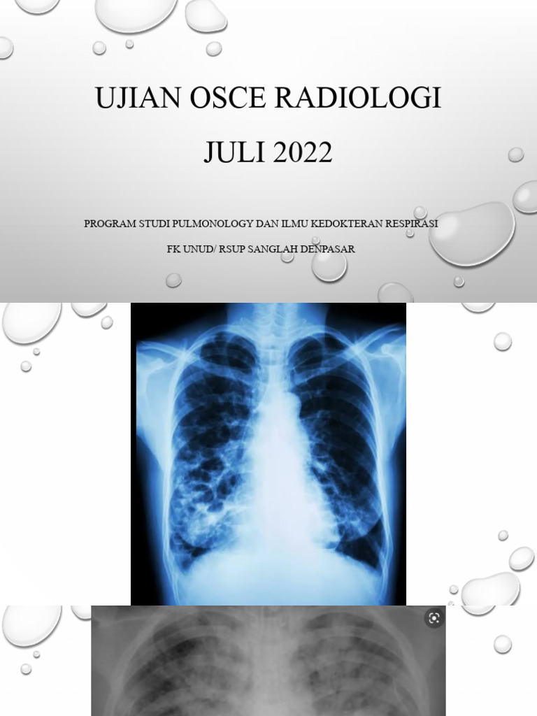 Ujian Osce Radiologi | PDF