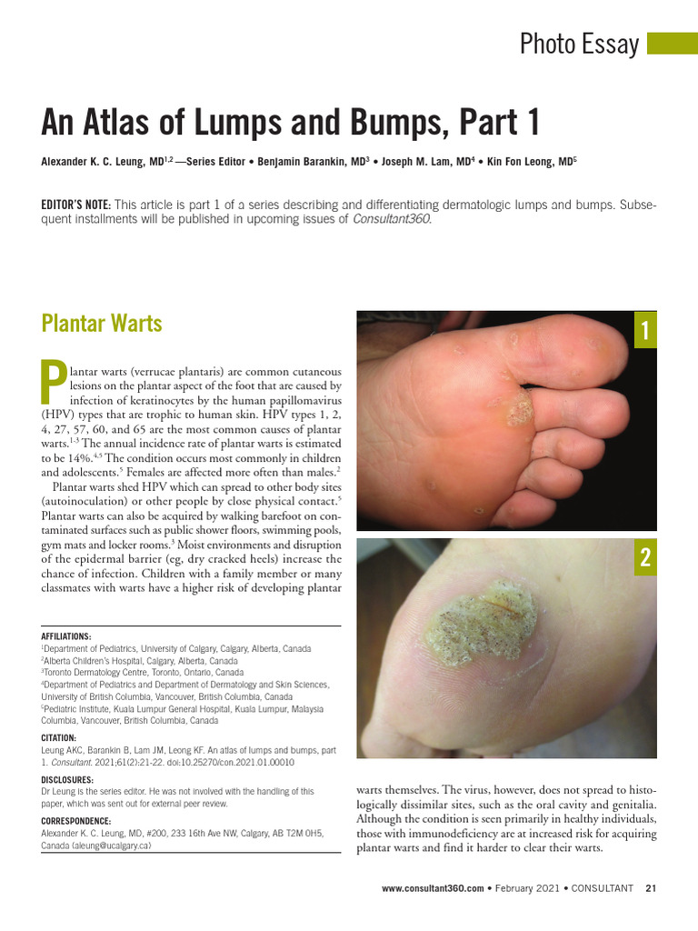 2102CON PE Lumps.v5 | PDF | Medical Specialties | Diseases And Disorders