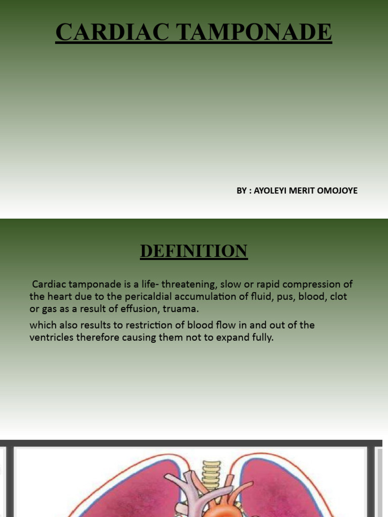 Cardiac Tamponade | PDF | Heart | Cardiology
