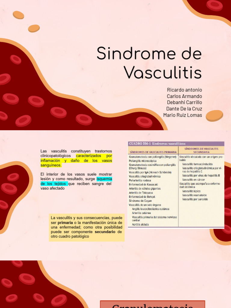 Sindrome de Vasculitis | PDF | Inflamación | Inmunología