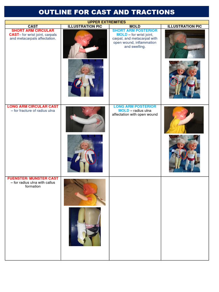 Outline Cast and Traction | PDF | Hip | Arm
