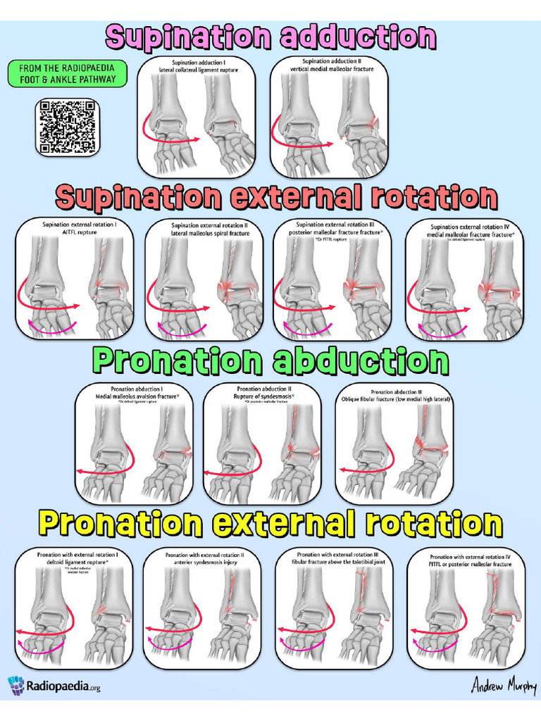 tipos fracturas de tobillo | PDF
