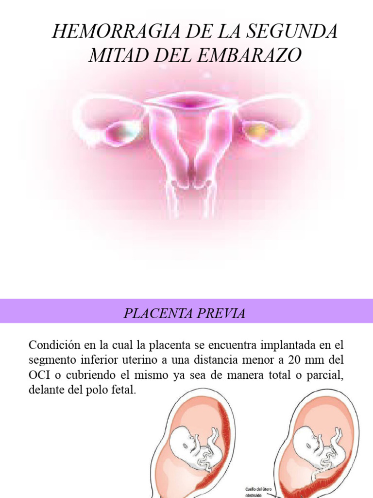 Hemorragia de La Segunda Mitad Del Embarazo | PDF | Obstetricia ...